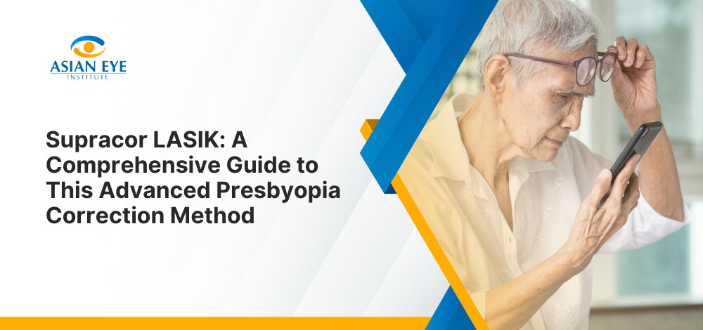 Supracor LASIK: A Comprehensive Guide to This Advanced Presbyopia ...