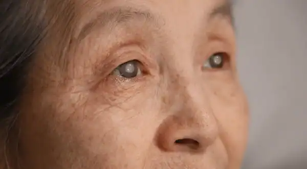 Cataracts: Signs and Symptoms | Asian Eye Institute